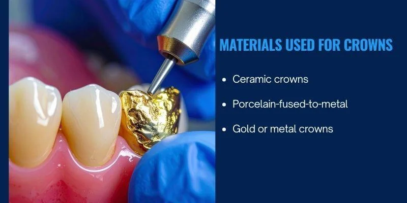Dental Onlay vs. Crown: Which Saves More Natural Tooth?